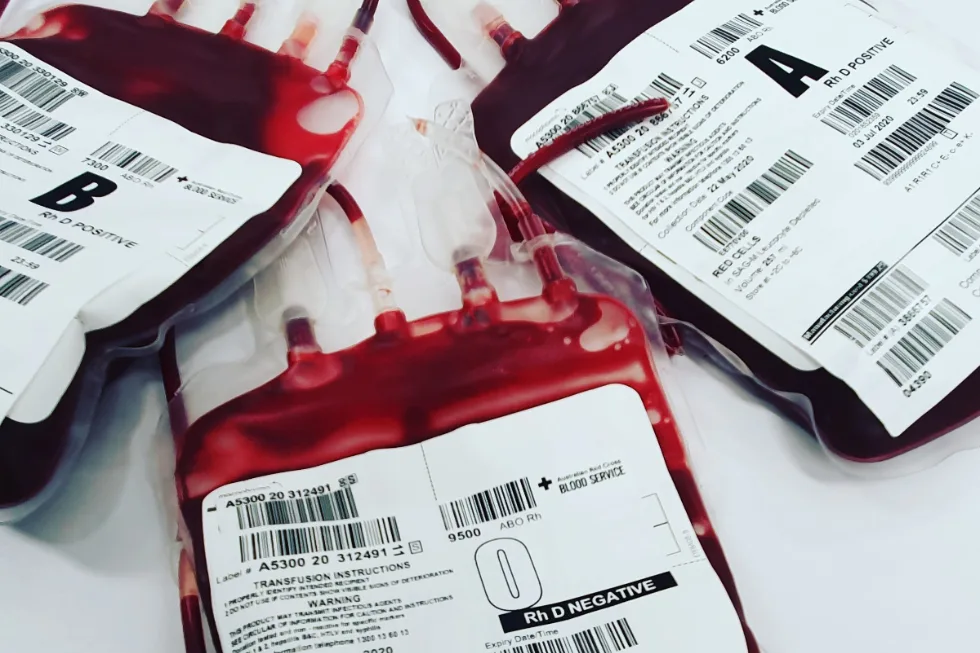 Inilah Gejala Anemia (5L), Kenali Untuk Melakukan Penanganan Tepat ...