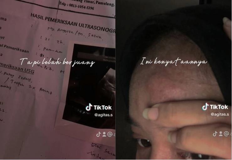 Viral Polisi Diduga Aniaya Kekasih hingga Paksa Gugurkan Kandungan ...